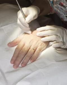 Dermatologist Bloomington, IL | Dermatology and Skin Cancer Center